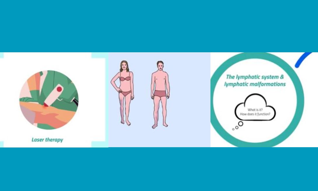 Three New Pills Of Knowledge Videos On Lymphatic Malformations And